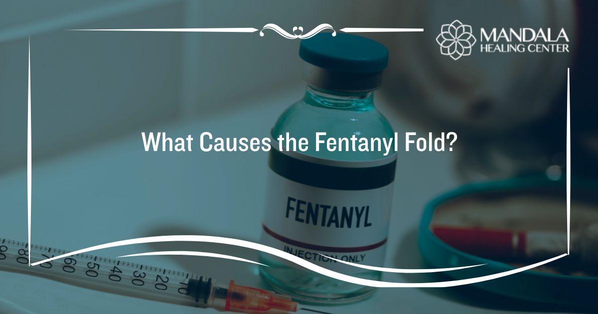 What is the “Fentanyl Fold”? Causes and Risks