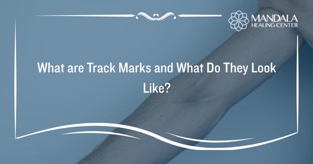 Track Marks: What They Look Like & Signs of IV Drug Use